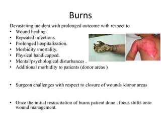 Burns dressings.pptx