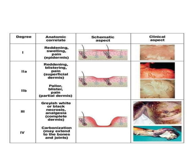 Burns dressings.pptx