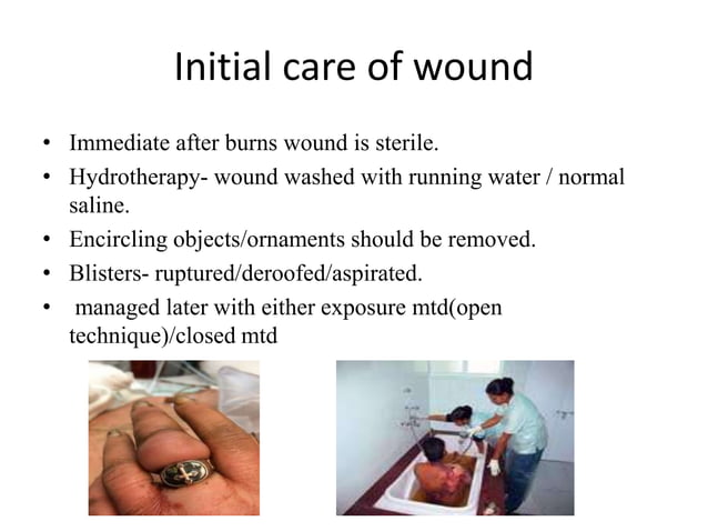 Burns dressings.pptx