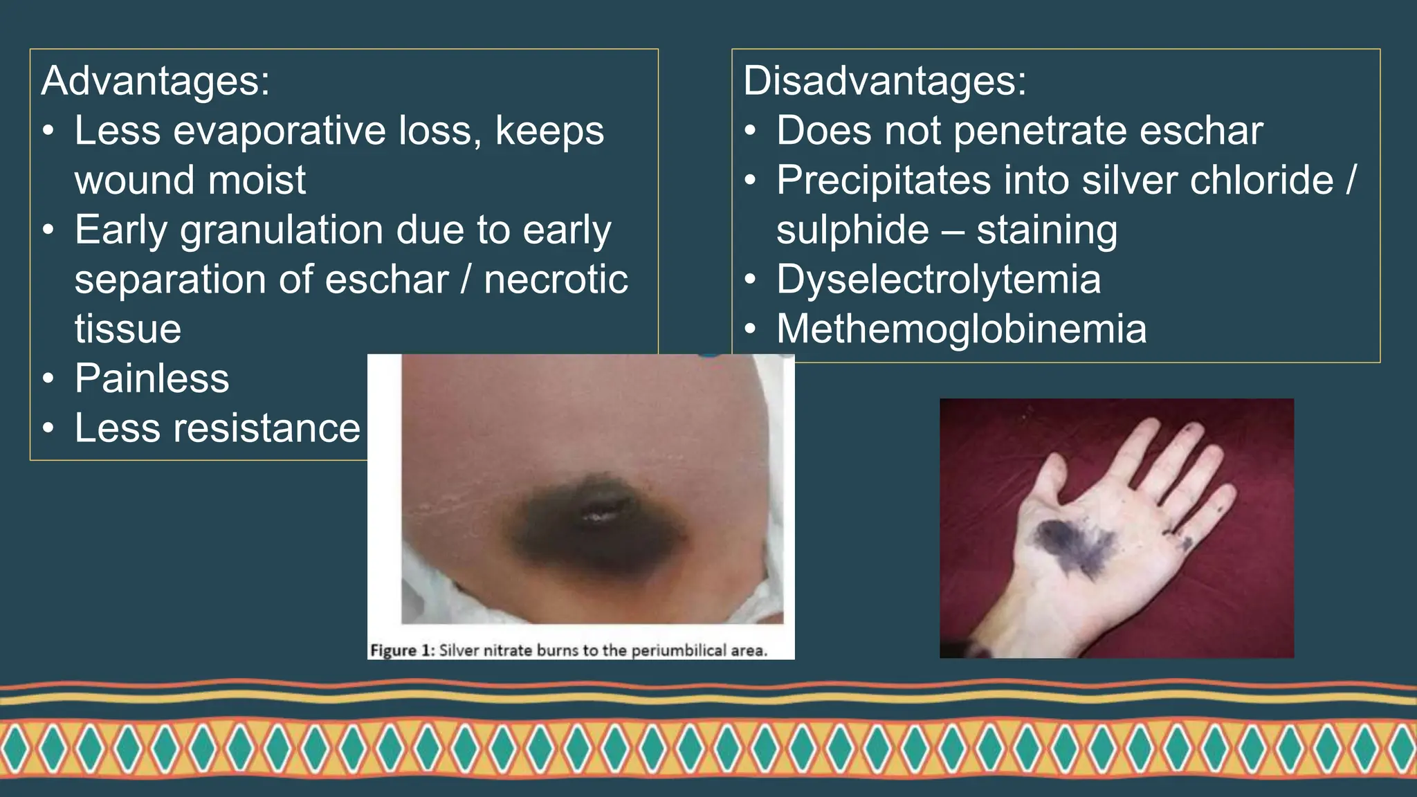 Aim of Burns Dressings and management of burns.pptx