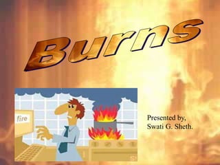 burns final ppt.ppt