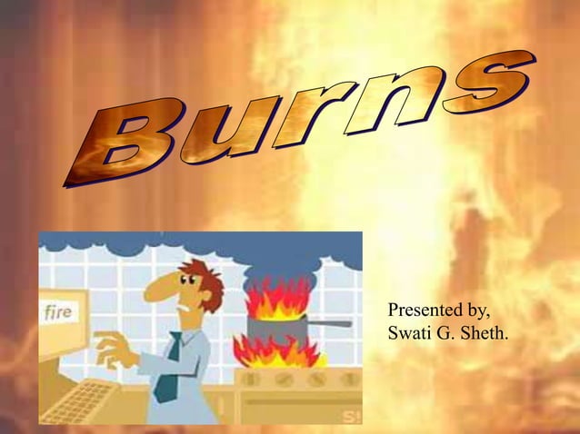 burns final ppt.ppt