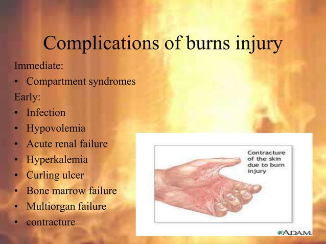 burns final ppt.ppt | First Aid | Injuries