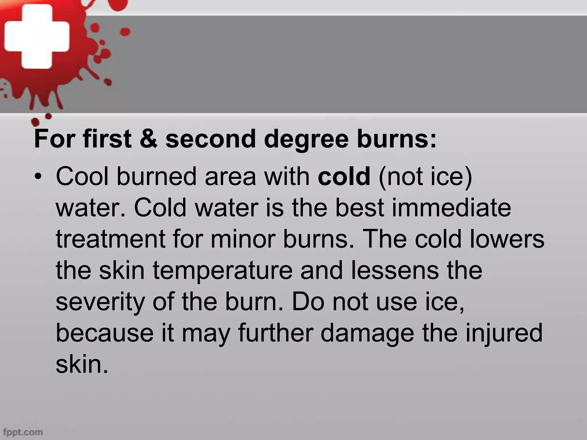 Burns first aid | PPTX