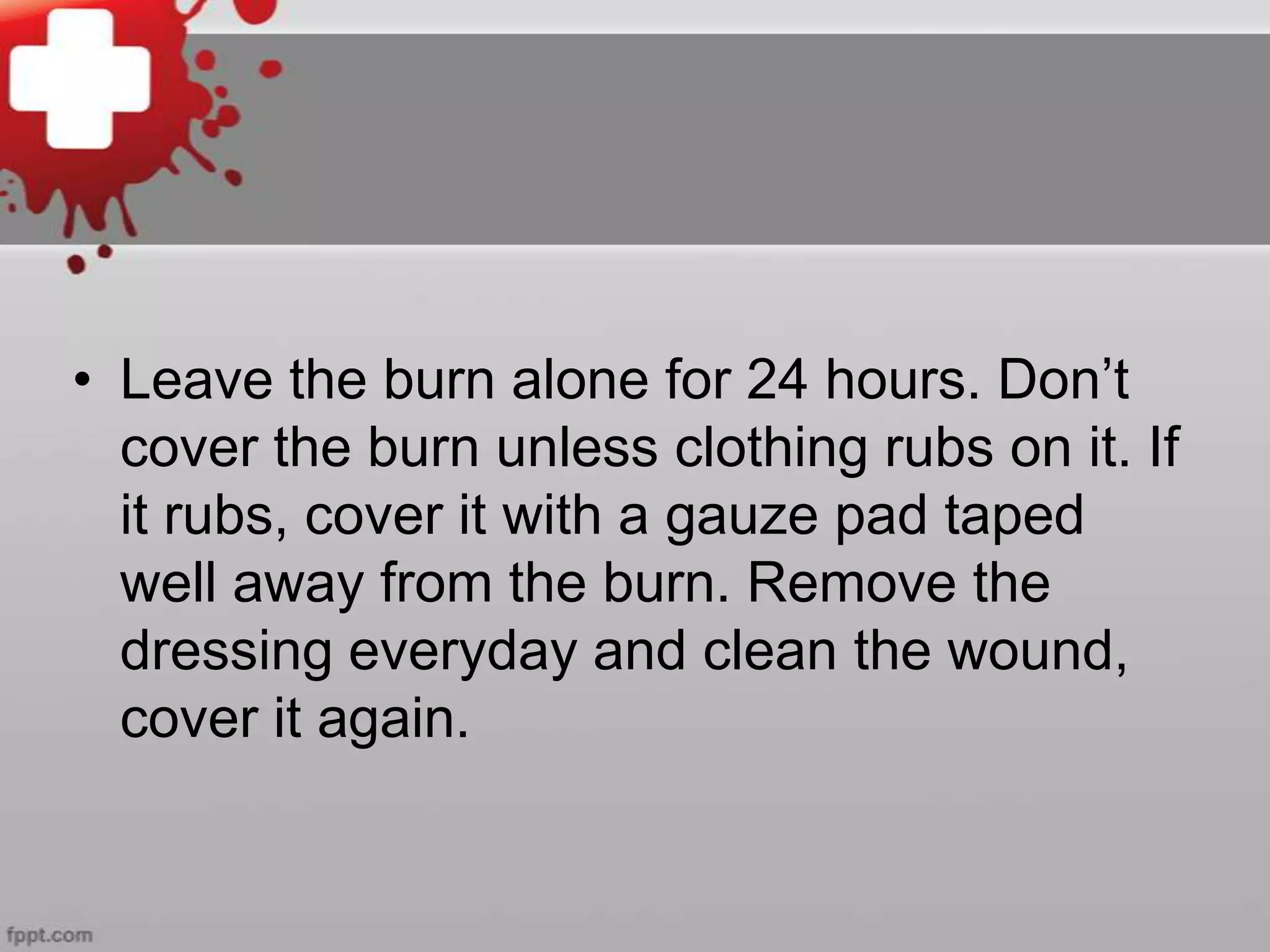 Burns first aid | PPTX