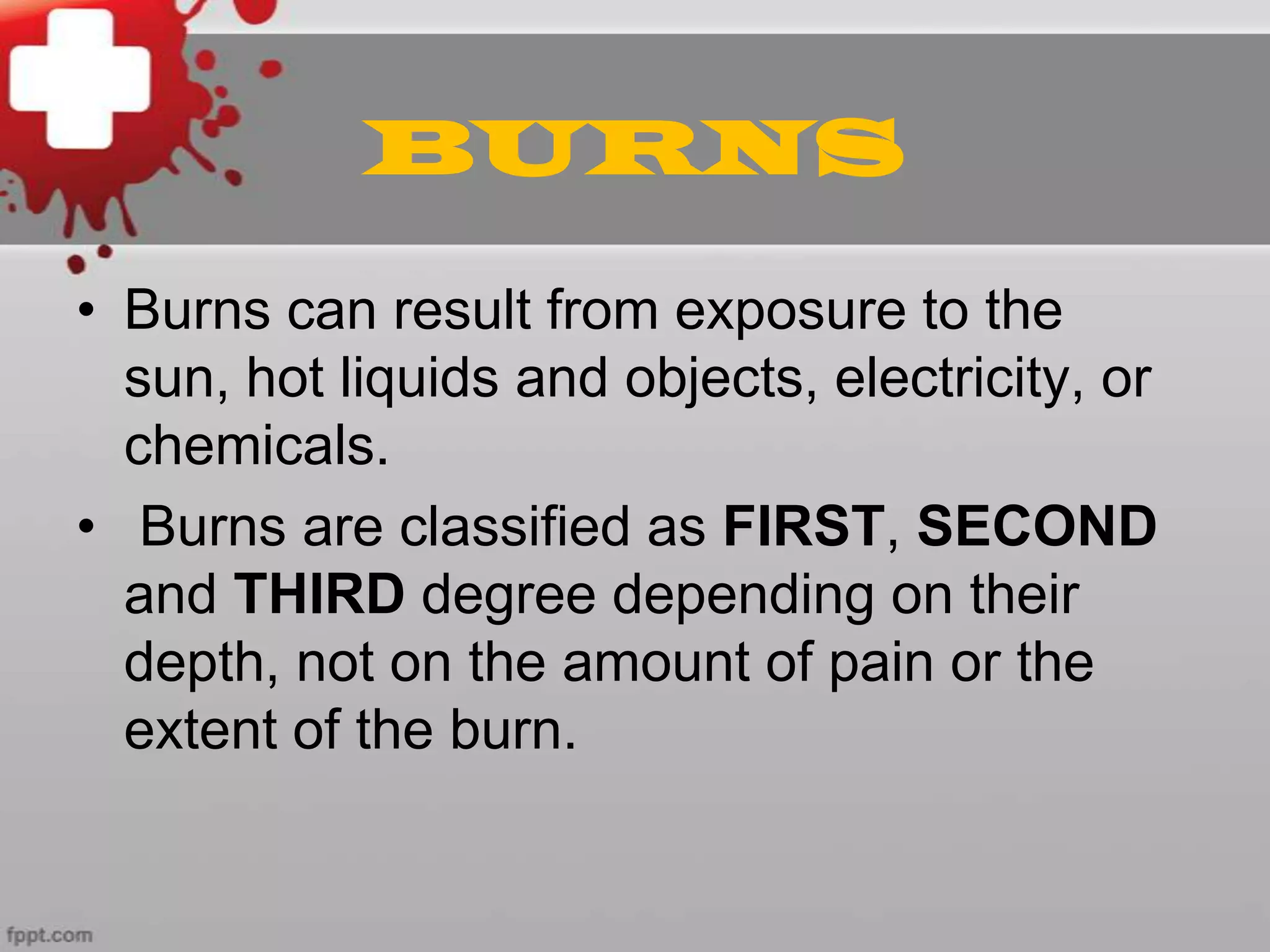Burns first aid | PPTX