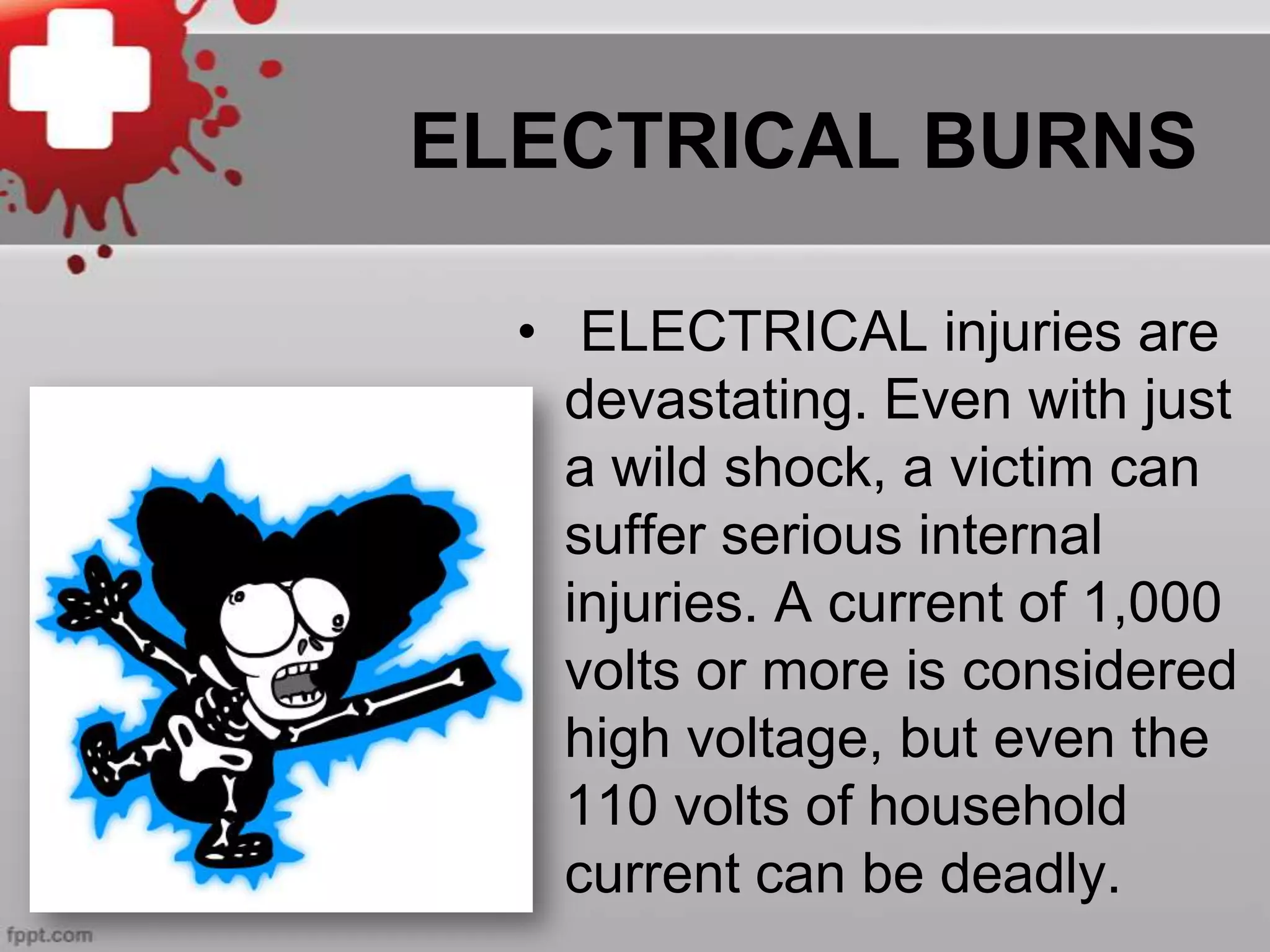Burns first aid | PPTX