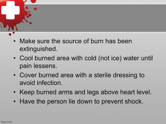 Burns first aid | PPTX