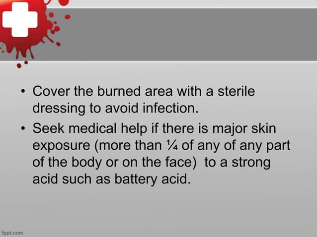 Burns first aid | PPTX