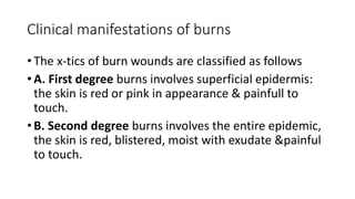 burns for home accidents in childre1.pdf