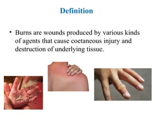 BURNS IN CHILDREN FOR 5 SEM BSC NURSING .pptx