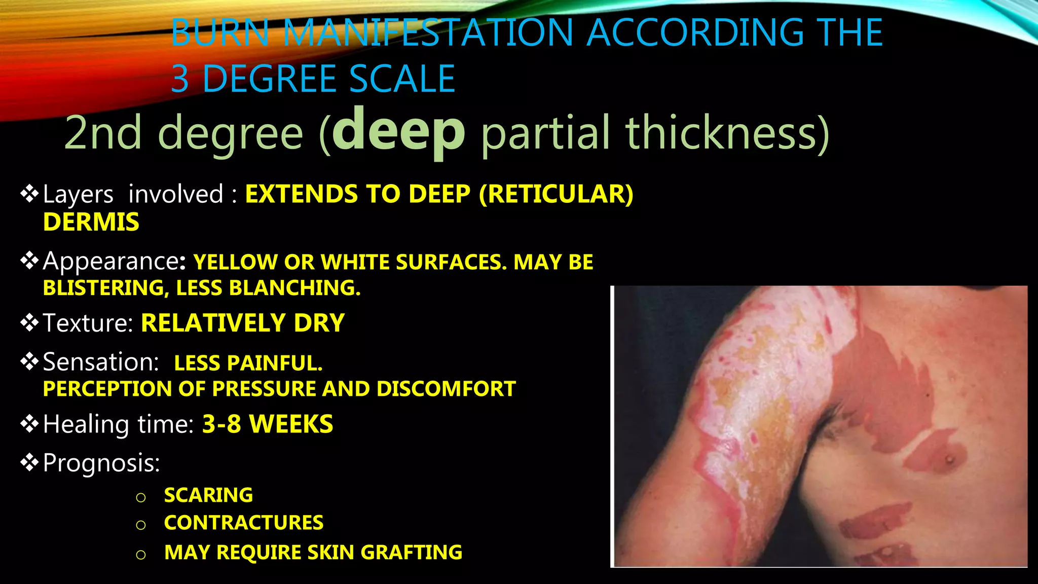 Burns in pediatrics presentation | PPTX | First Aid | Injuries