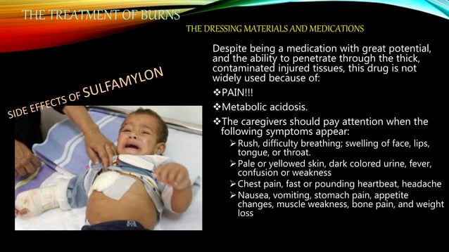 Burns in pediatrics presentation | PPTX | First Aid | Injuries