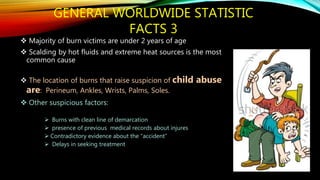 Burns in pediatrics presentation | PPT