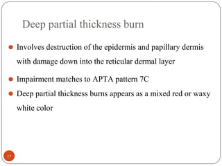 Burns & its Physiotherapy Management..pptx