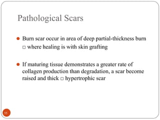 Burns & its Physiotherapy Management..pptx