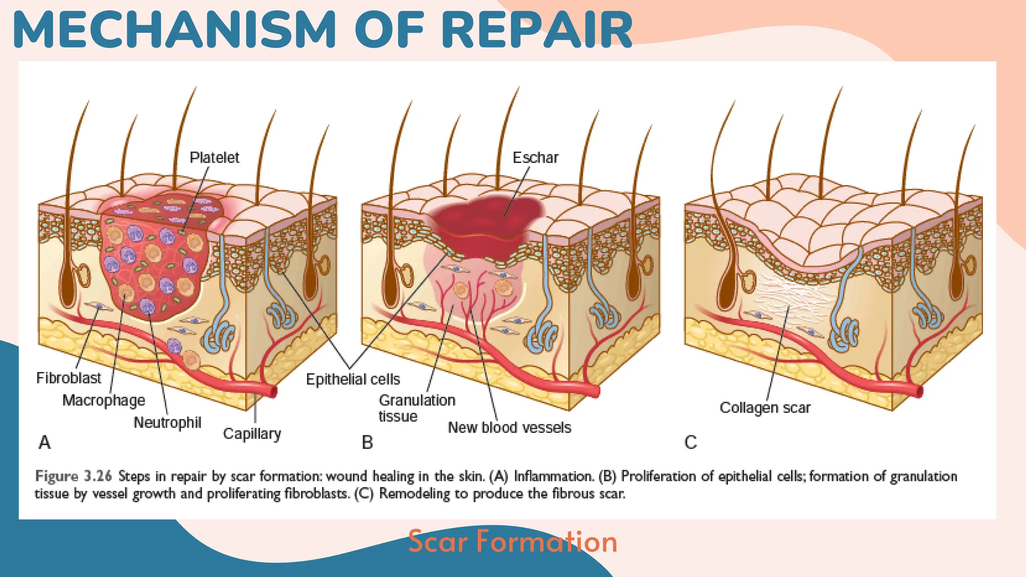Burns (Trauma) Powerpoint - Medical School | PDF