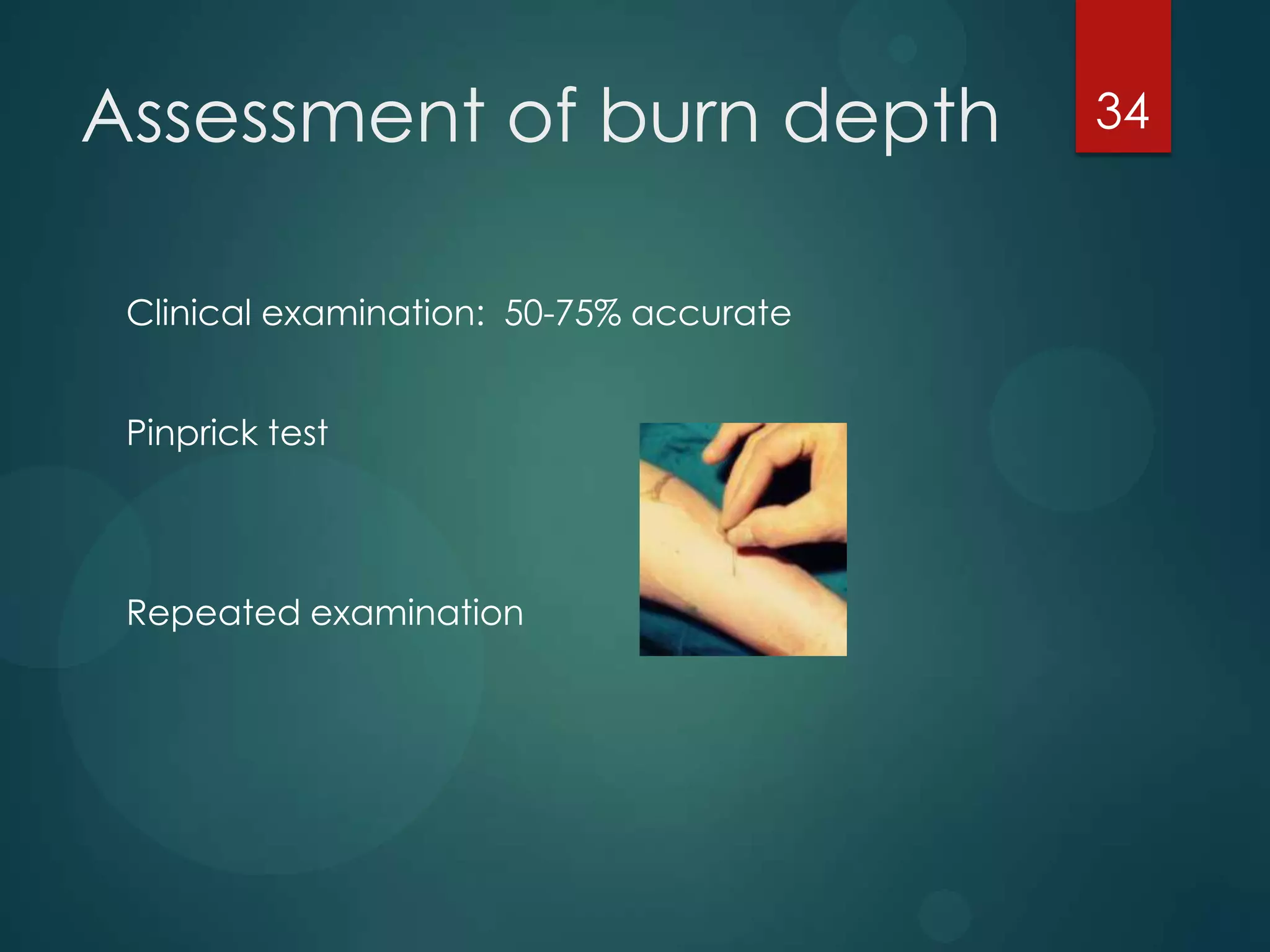Burns management | PPTX