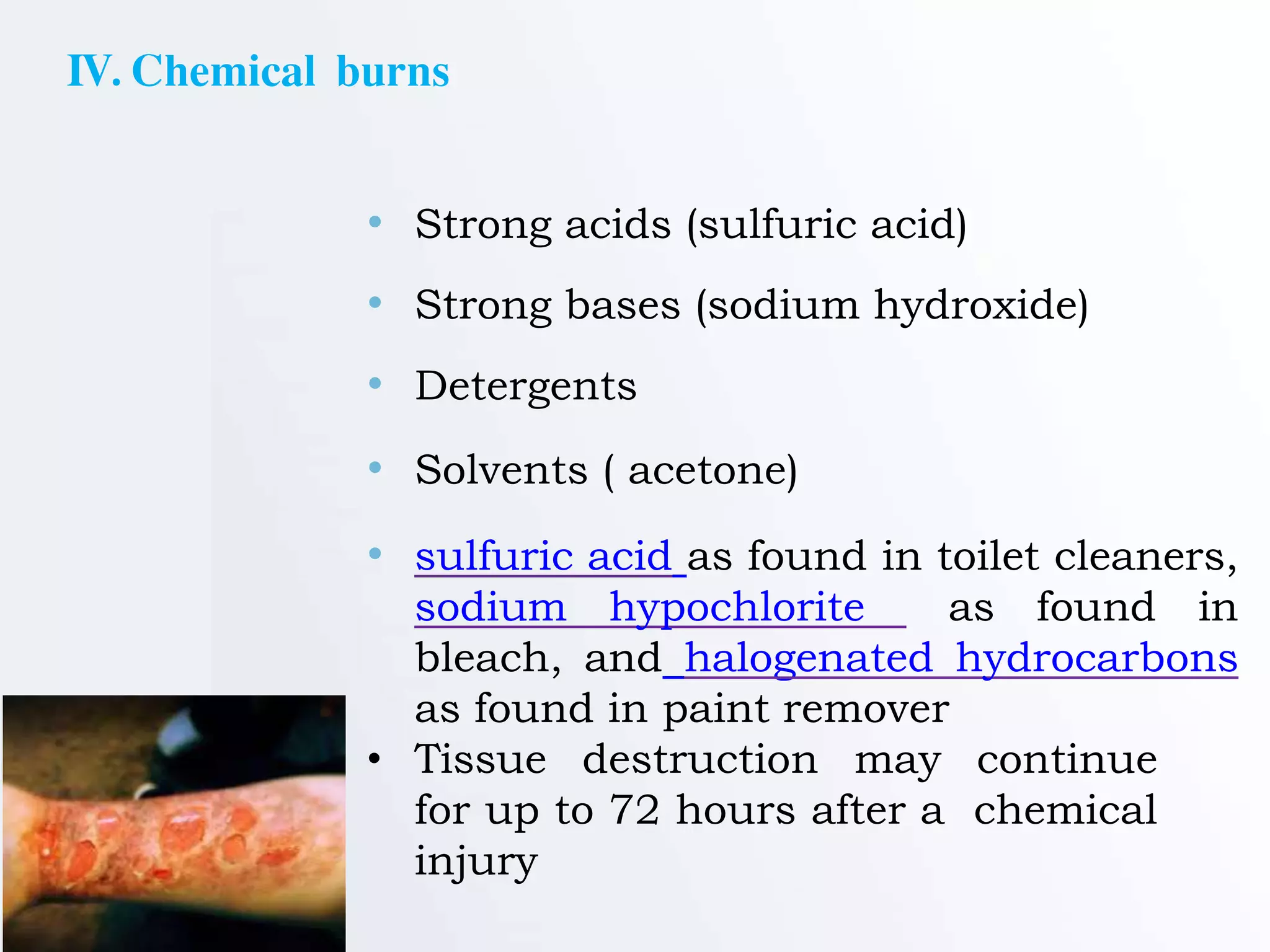 BURNS TYPES AND ITS MANAGEMENT | PPTX