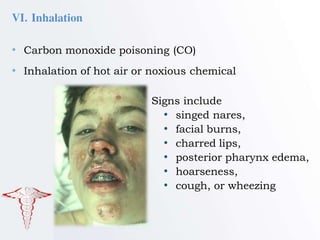 BURNS TYPES AND ITS MANAGEMENT | PPTX