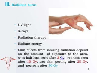 BURNS TYPES AND ITS MANAGEMENT | PPTX
