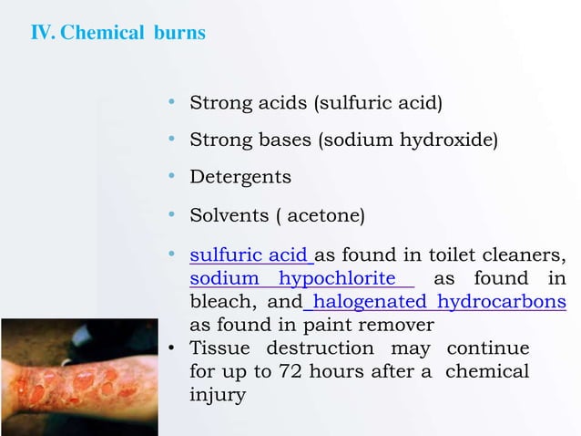 BURNS TYPES AND ITS MANAGEMENT | PPTX | First Aid | Injuries
