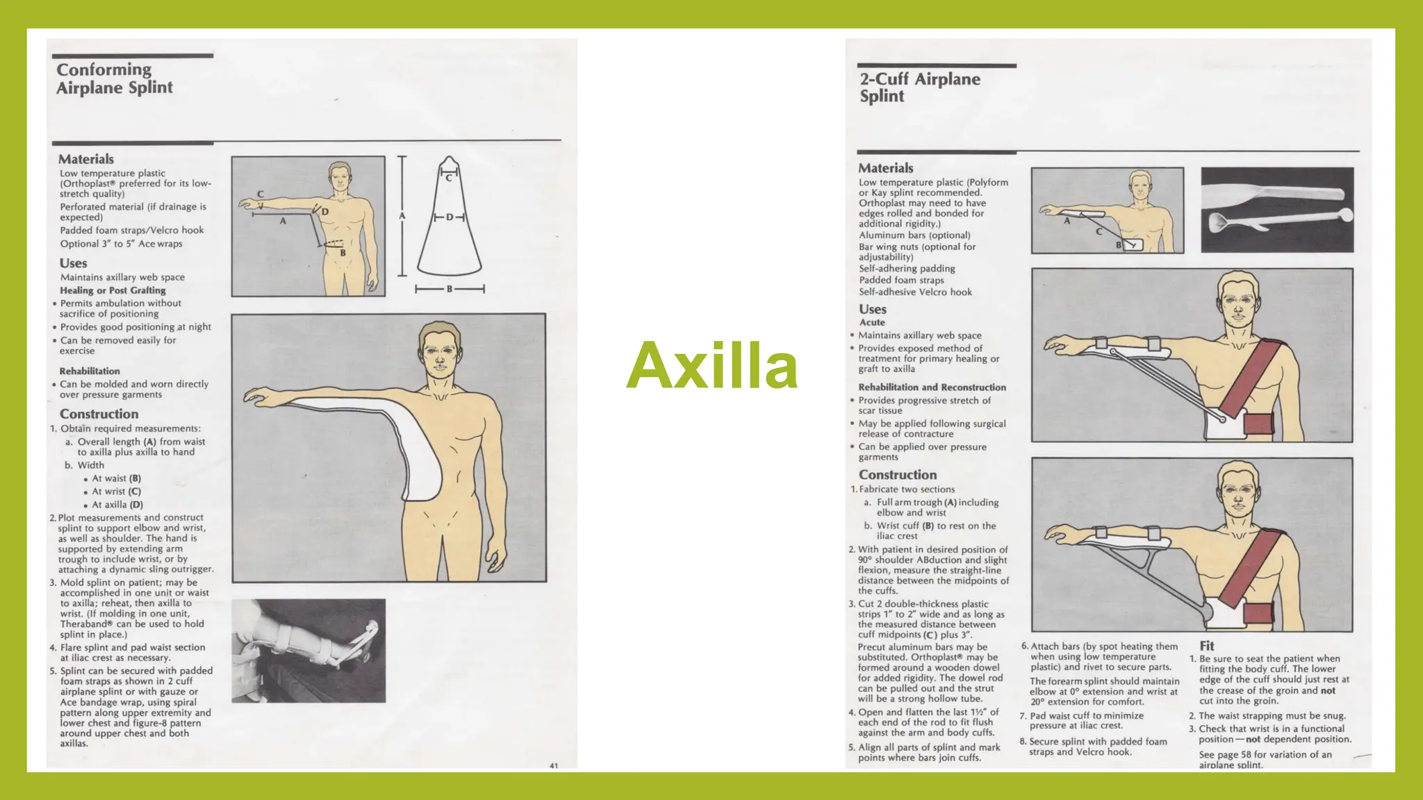 Burns - types, evaluation and occupational therapy | PPTX