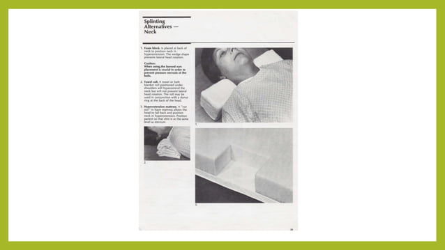 Burns - types, evaluation and occupational therapy | PPTX