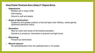 Burns - types, evaluation and occupational therapy | PPTX
