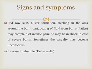 BURNS NEW PPT.pptx