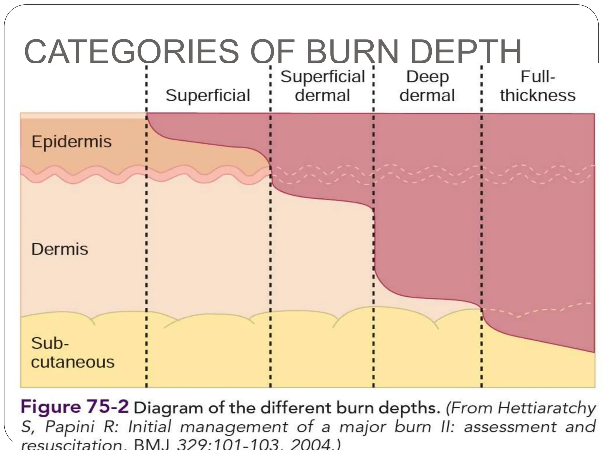 BURNS in Pediatrics patients by Peculiar OLURONKE.pptx