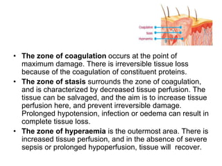 Burns in Children | PPTX