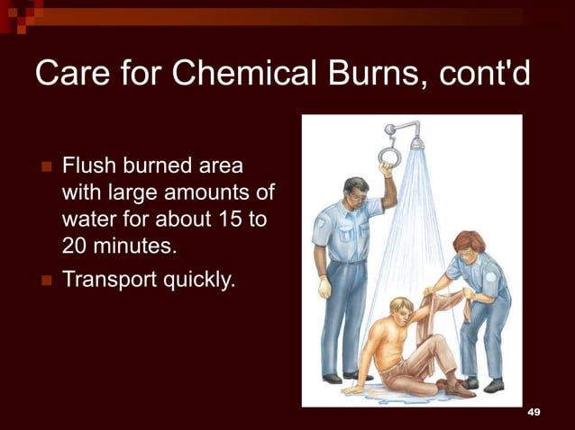 Burns ppt | PPT
