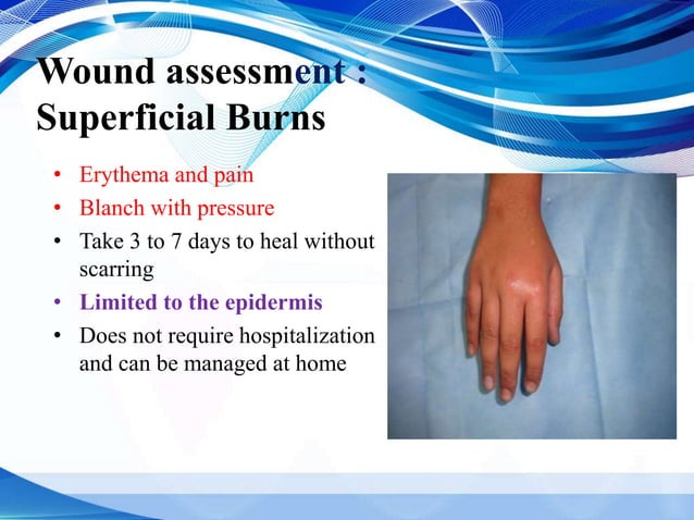 Burns ppt.pptx
