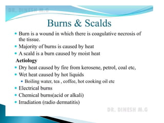 burns for first aid management ppt.pptx