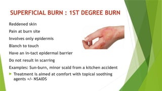 Burns presentation. | PPTX