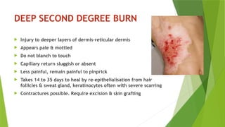 Burns presentation. | PPTX