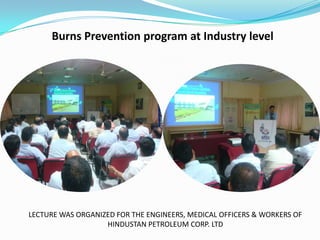 Burns prevention program in Mumbai by Dr. Sunil Keswani, National Burns ...