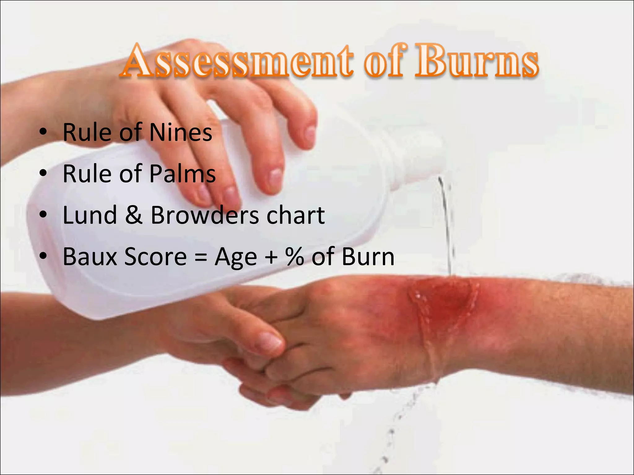 Pathophysiology, Nutritional Management of BURNS | PPT