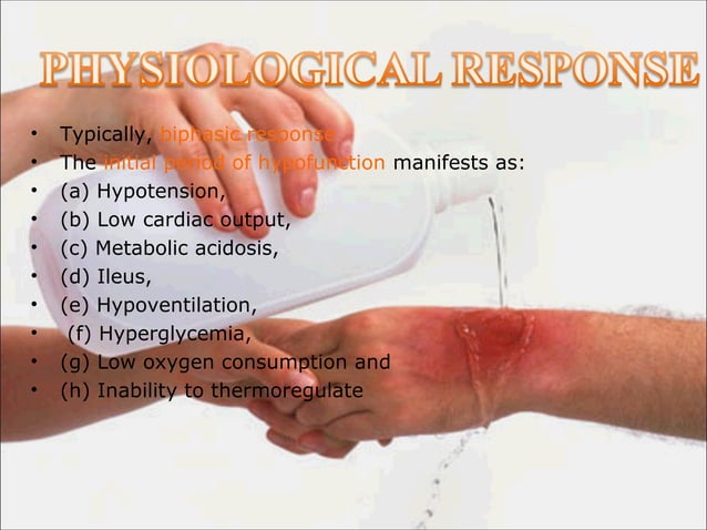 Pathophysiology, Nutritional Management of BURNS | PPT | First Aid ...