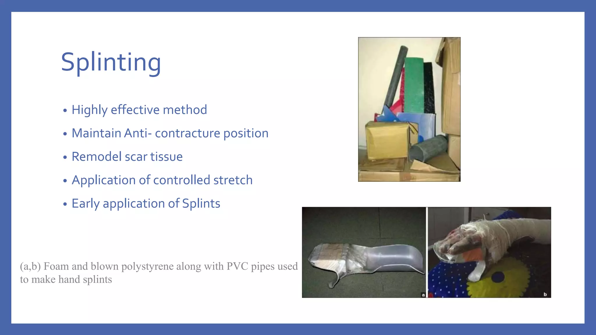 Burns Rehabilitation.pptx