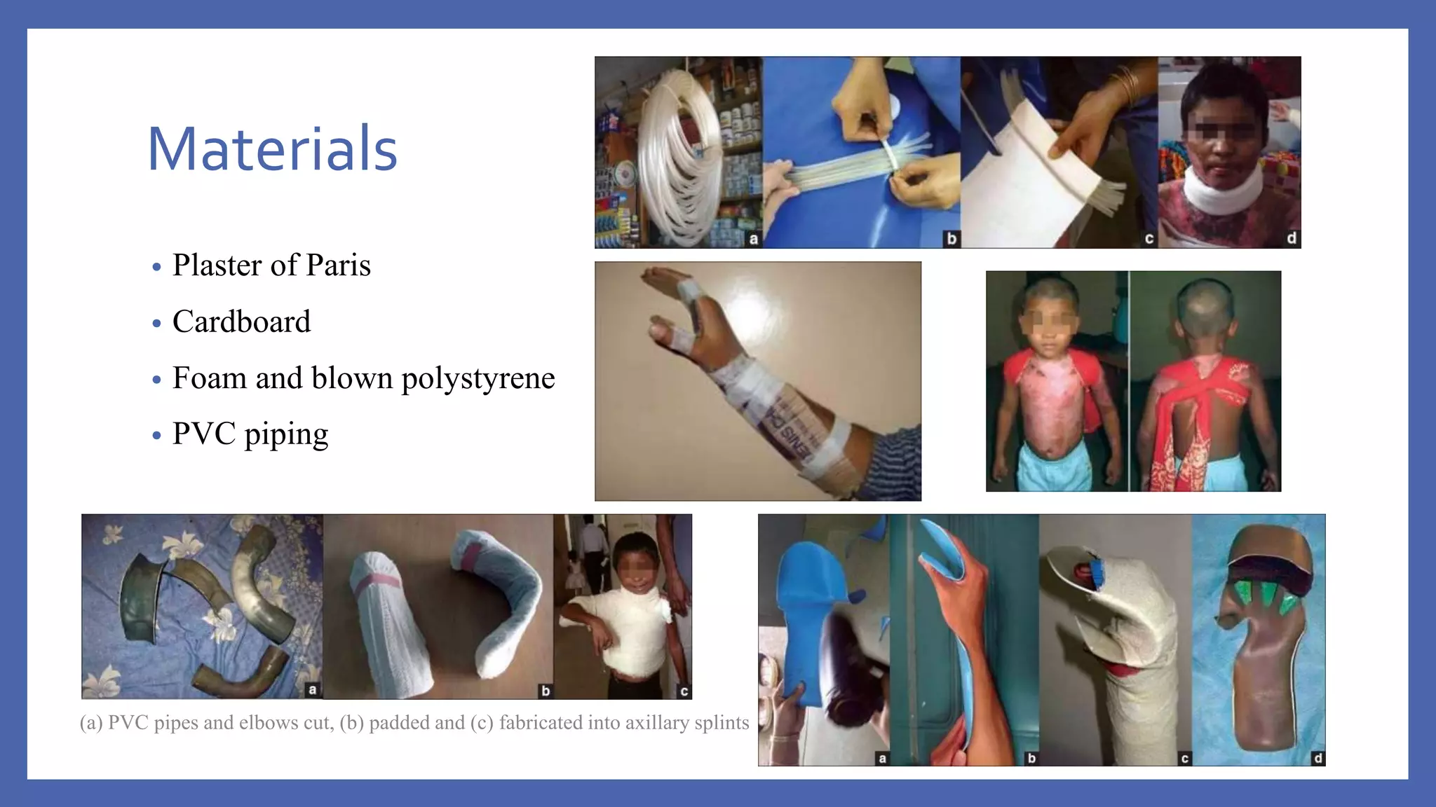 Burns Rehabilitation.pptx