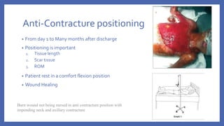 Burns Rehabilitation.pptx