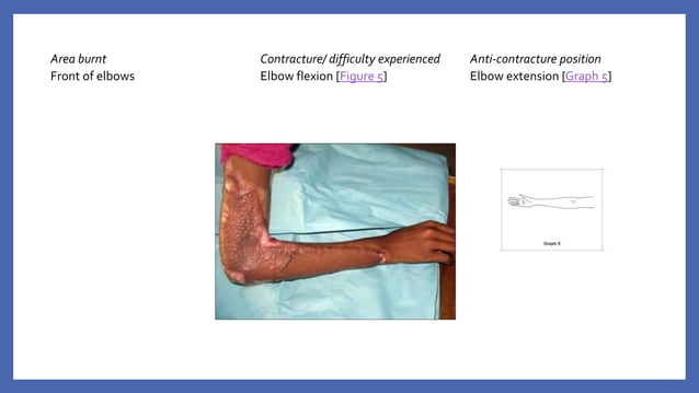 Burns Rehabilitation.pptx