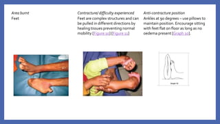 Burns Rehabilitation.pptx
