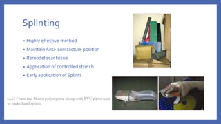 Burns Rehabilitation.pptx