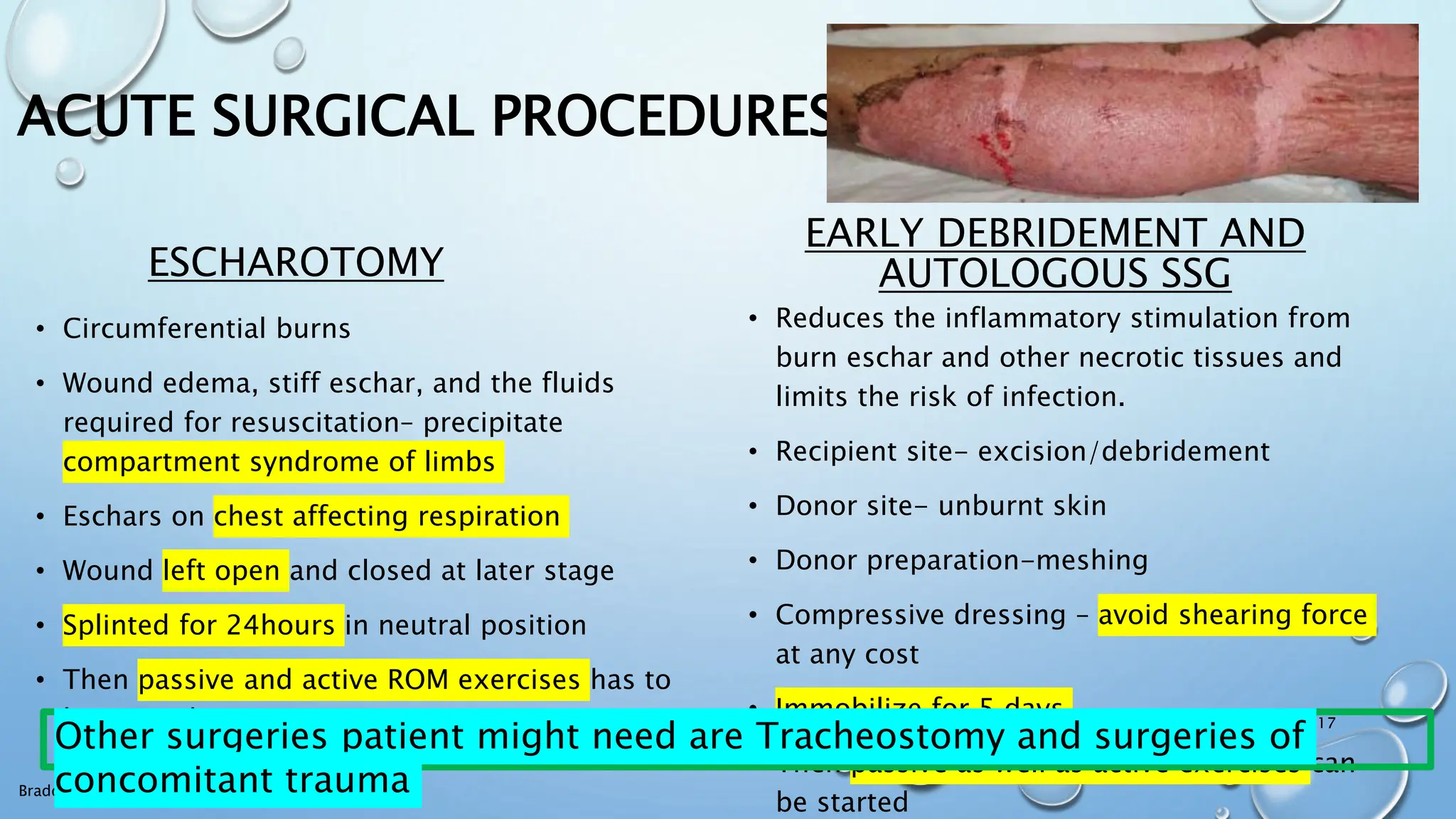 Burns Rehabilitation | PPTX