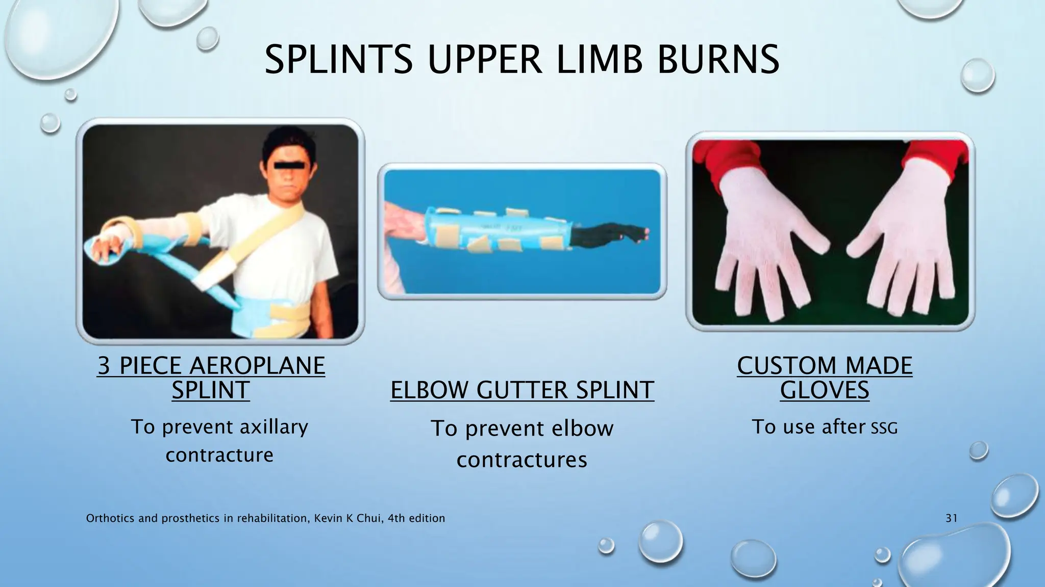 Burns Rehabilitation | PPTX