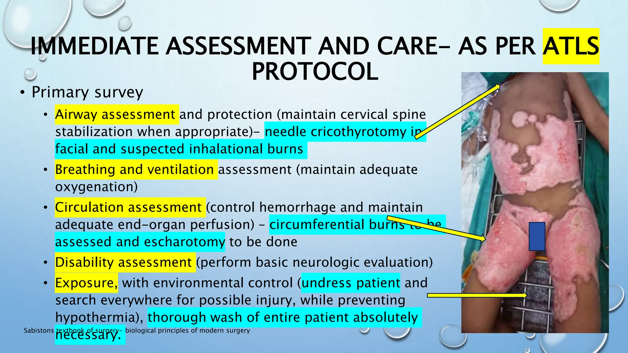 Burns Rehabilitation | PPTX