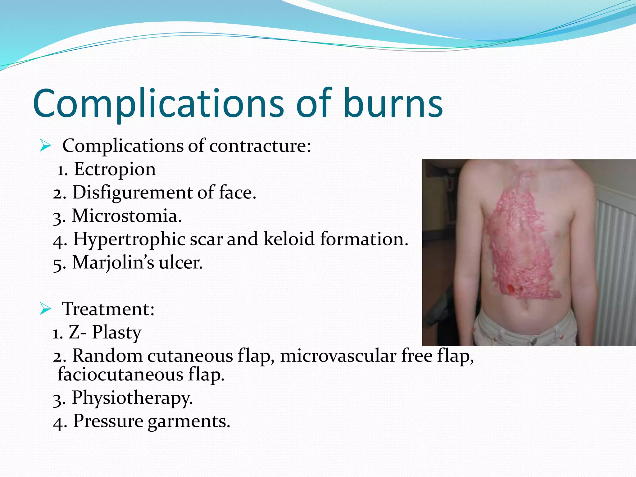 BURNS | PPTX
